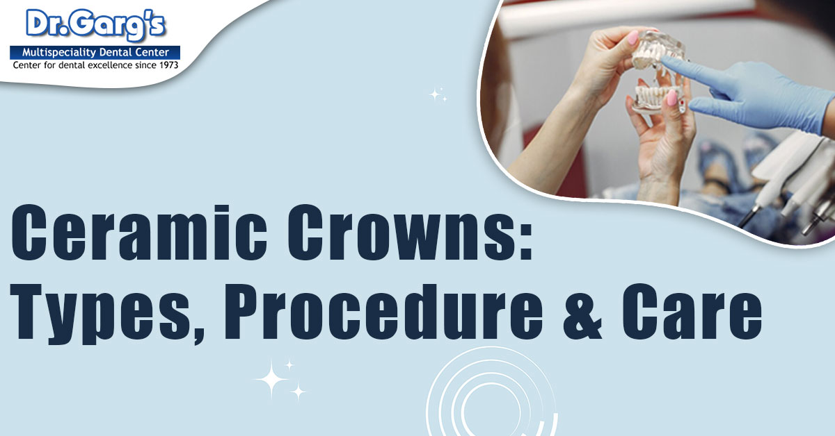 Ceramic Crowns: Types, Procedure & Care